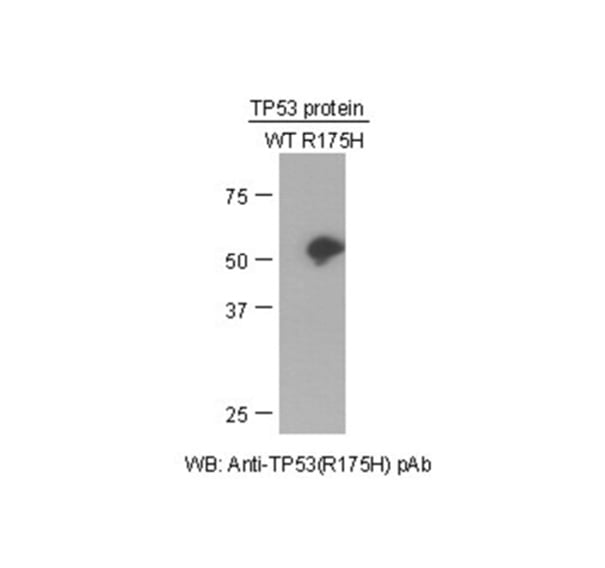 TP53(R175H) 多抗 - 费斯德-GTP酶和癌基因产品
