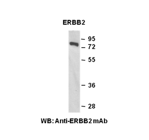 ERBB2 小鼠单抗 - 费斯德-GTP酶和癌基因产品