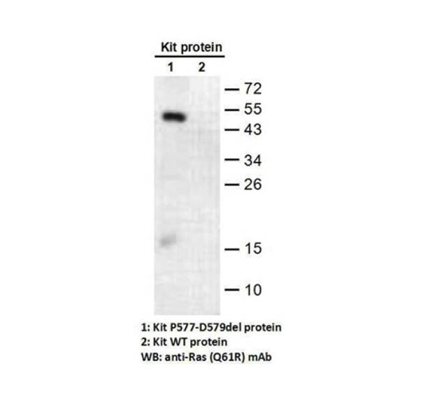 KIT(P577-D579 DEL) 小鼠单抗 - 费斯德-GTP酶和癌基因产品