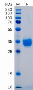Human PD-L1 Protein, His tag - NewEast Biosciences - GTPase, Oncogene ...