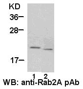 Rab2A pAb - NewEast Biosciences - GTPase, Oncogene and Bioactive Protein