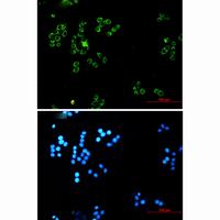 Lipoamide Dehydrogenase Rabbit mAb - NewEast Biosciences - GTPase ...