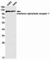 Interferon alpha/beta Receptor 1 Rabbit mAb - 费斯德 - GTP酶、癌症点突变、活性蛋白产品