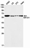 NR1D1 Rabbit mAb - 费斯德 - GTP酶、癌症点突变、活性蛋白产品