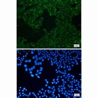 SEC61A Rabbit mAb - NewEast Biosciences - GTPase, Oncogene and ...