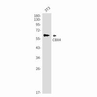 CBX4 Rabbit mAb - NewEast Biosciences - GTPase, Oncogene and Bioactive ...